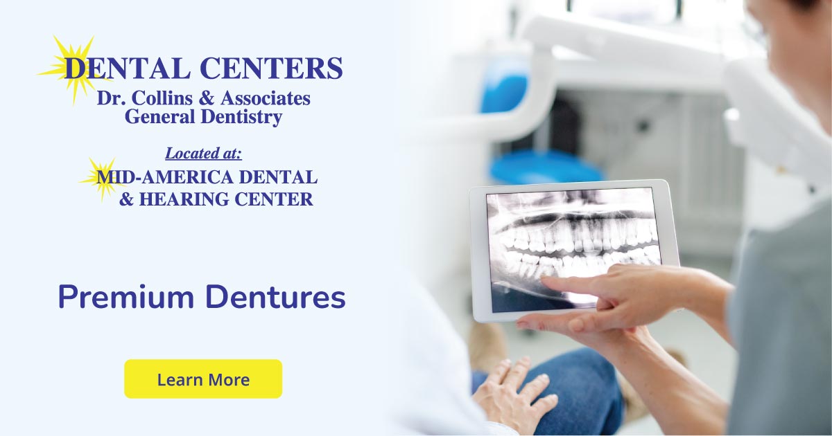 Premium Complete Dentures | Mid America Dental Center